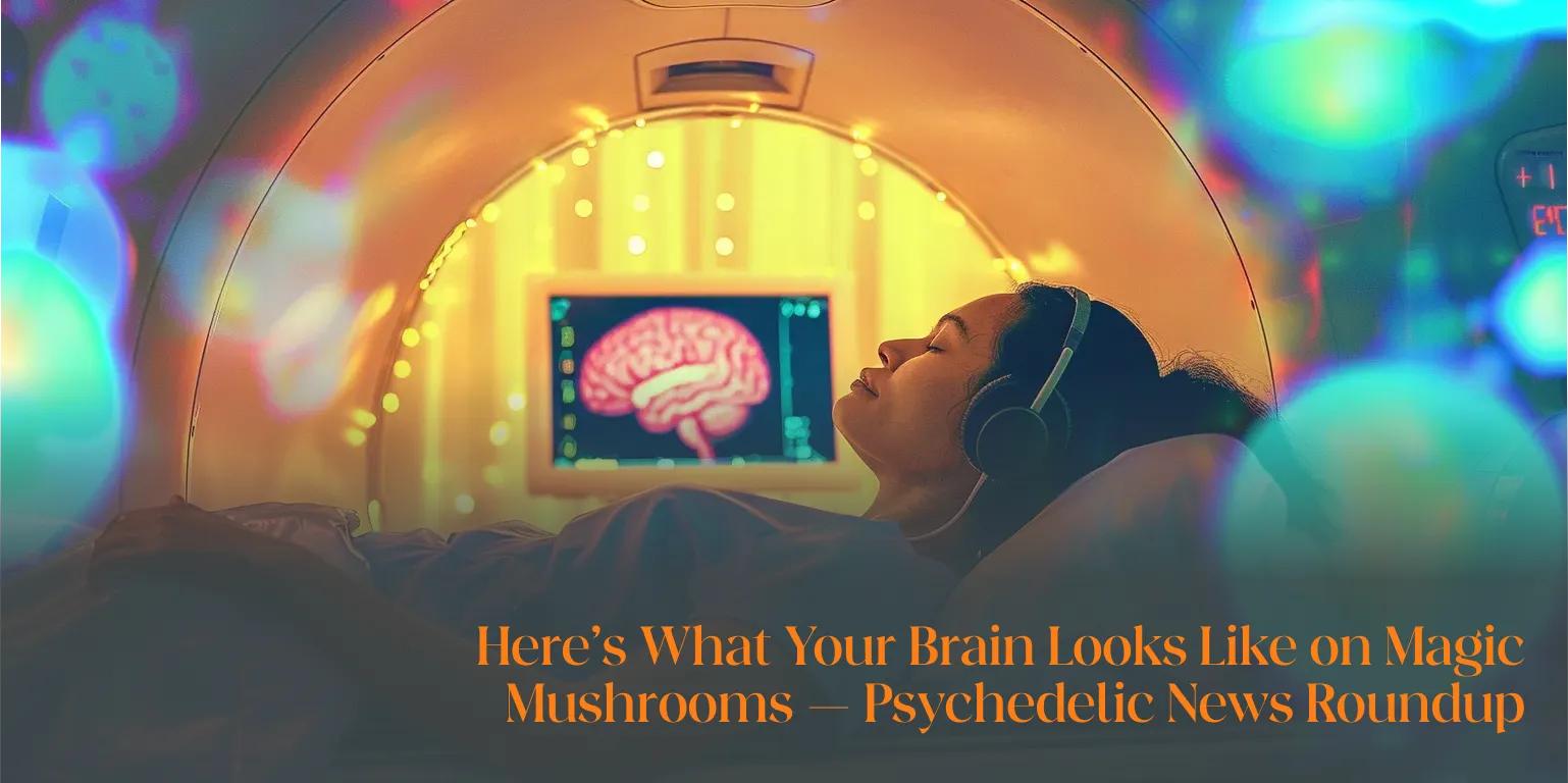 What Does Your Brain Look Like on Psychedelics – Psychedelic News Roundup